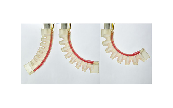 Multi-Material 3D Printed Stent Automatically Expands and Delivers Drugs