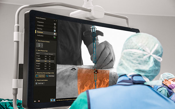 Philips Debutes Surgical Procedures Enabled by 3D Printing and ...