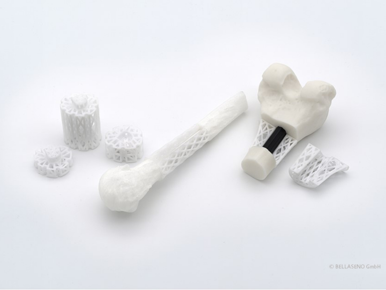 BellaSeno's Unveils 3D Printed Scaffolds for Bone Reconstruction - 3D ...